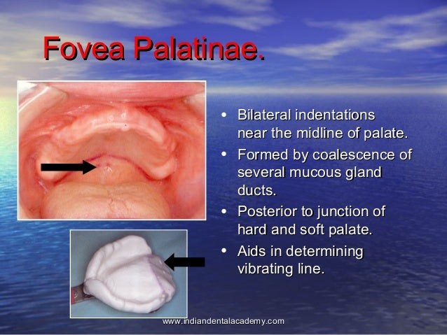 Anatomical landmarks/ dental implant courses by Indian dental academy