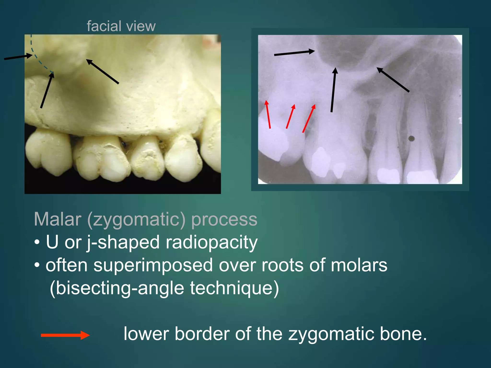 Anatomical landmarks | PPT