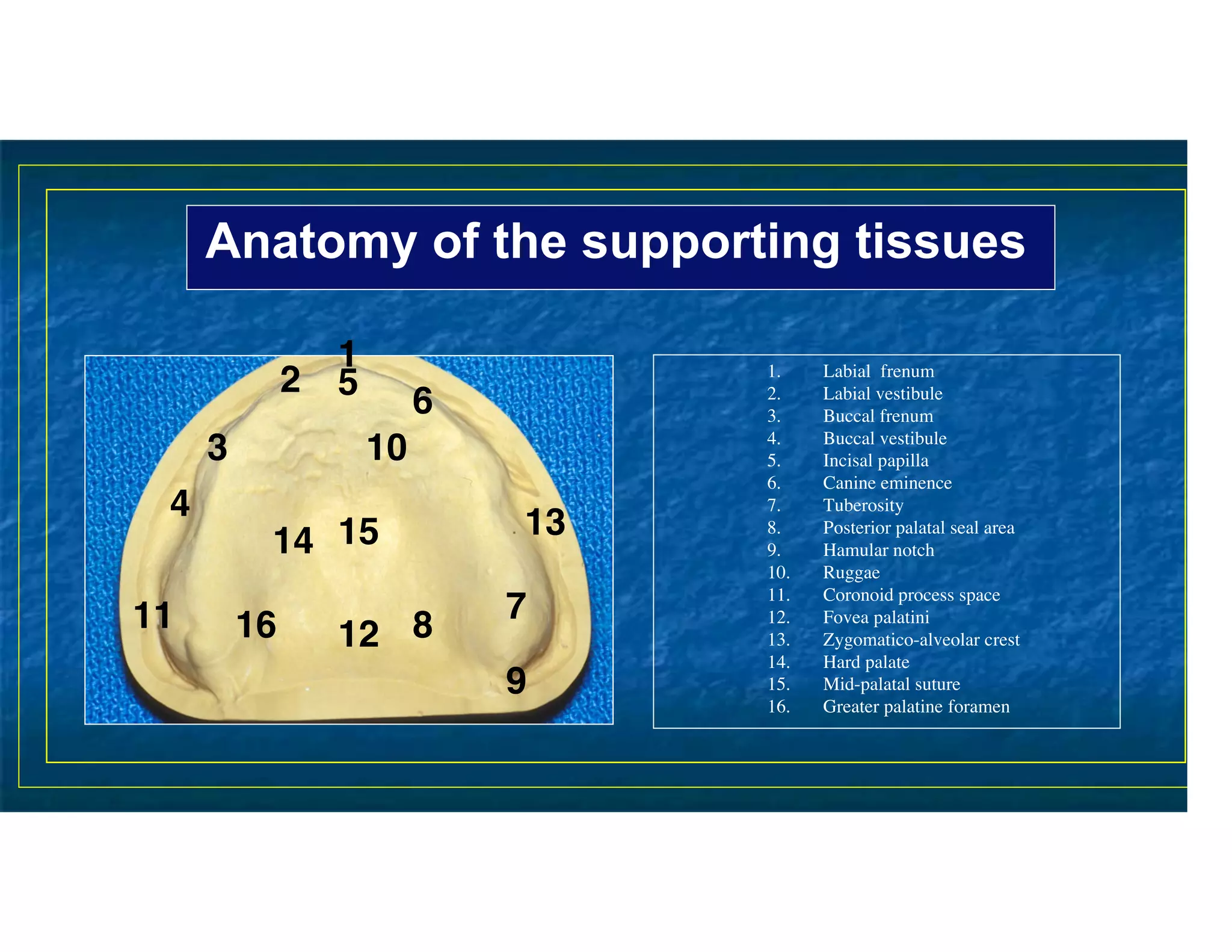 Edentulous Ridges_Anatomical Landmark | PDF