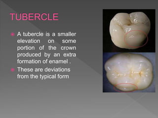 ANATOMICAL LANDMARKS.pptx