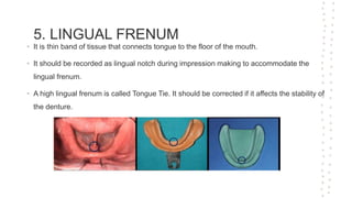 anatomical Landmarks in the mandible.pptx