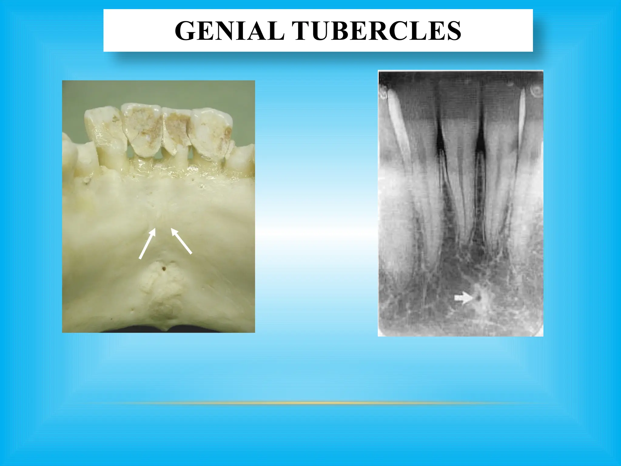 ANATOMICAL LANDMARKS anatomy and physiology.pptx