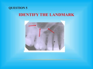 ANATOMICAL LANDMARKS anatomy and physiology.pptx