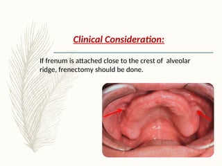 ANATOMICAL LANDMARKS OF ANATOMICAL STRUCTURES.ppt
