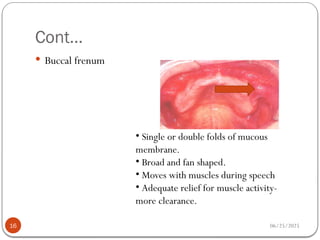 Anatomical landmarks for complete denture .pptx