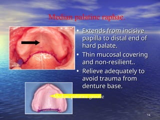 ANATOMICAL LANDMARKS of maxillary and mandibulat arches.ppt