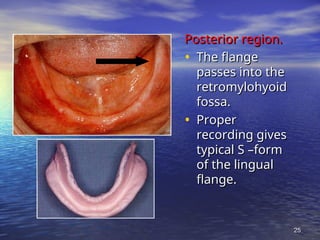 ANATOMICAL LANDMARKS of maxillary and mandibulat arches.ppt