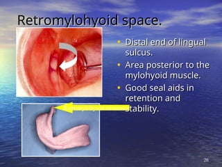 ANATOMICAL LANDMARKS of maxillary and mandibulat arches.ppt