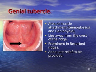 ANATOMICAL LANDMARKS of maxillary and mandibulat arches.ppt