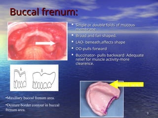 ANATOMICAL LANDMARKS of maxillary and mandibulat arches.ppt