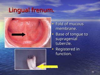 ANATOMICAL LANDMARKS of maxillary and mandibulat arches.ppt