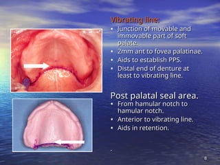 ANATOMICAL LANDMARKS of maxillary and mandibulat arches.ppt
