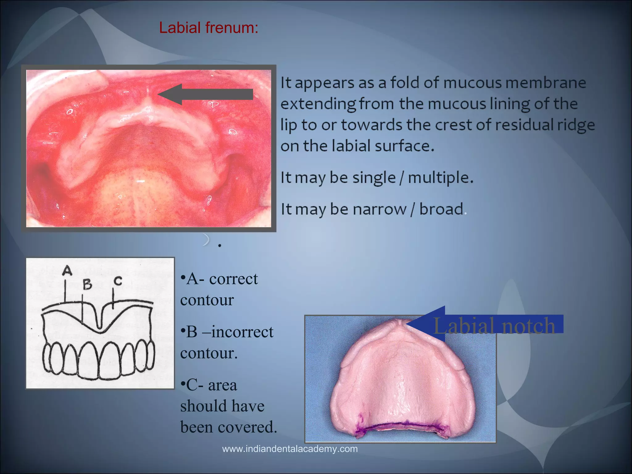 Anatomical landmarks (2)/prosthodontic courses | PPT