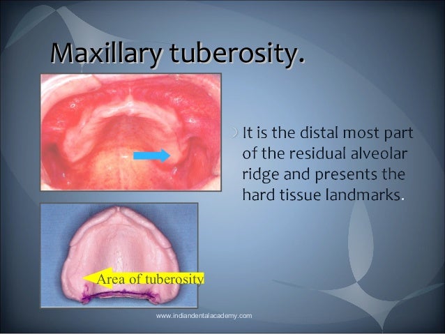 Anatomical landmarks (2)/prosthodontic courses
