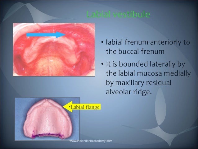 Anatomical landmarks (2)/prosthodontic courses
