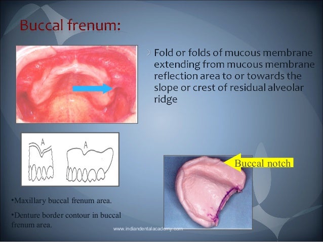 Anatomical landmarks (2)/prosthodontic courses