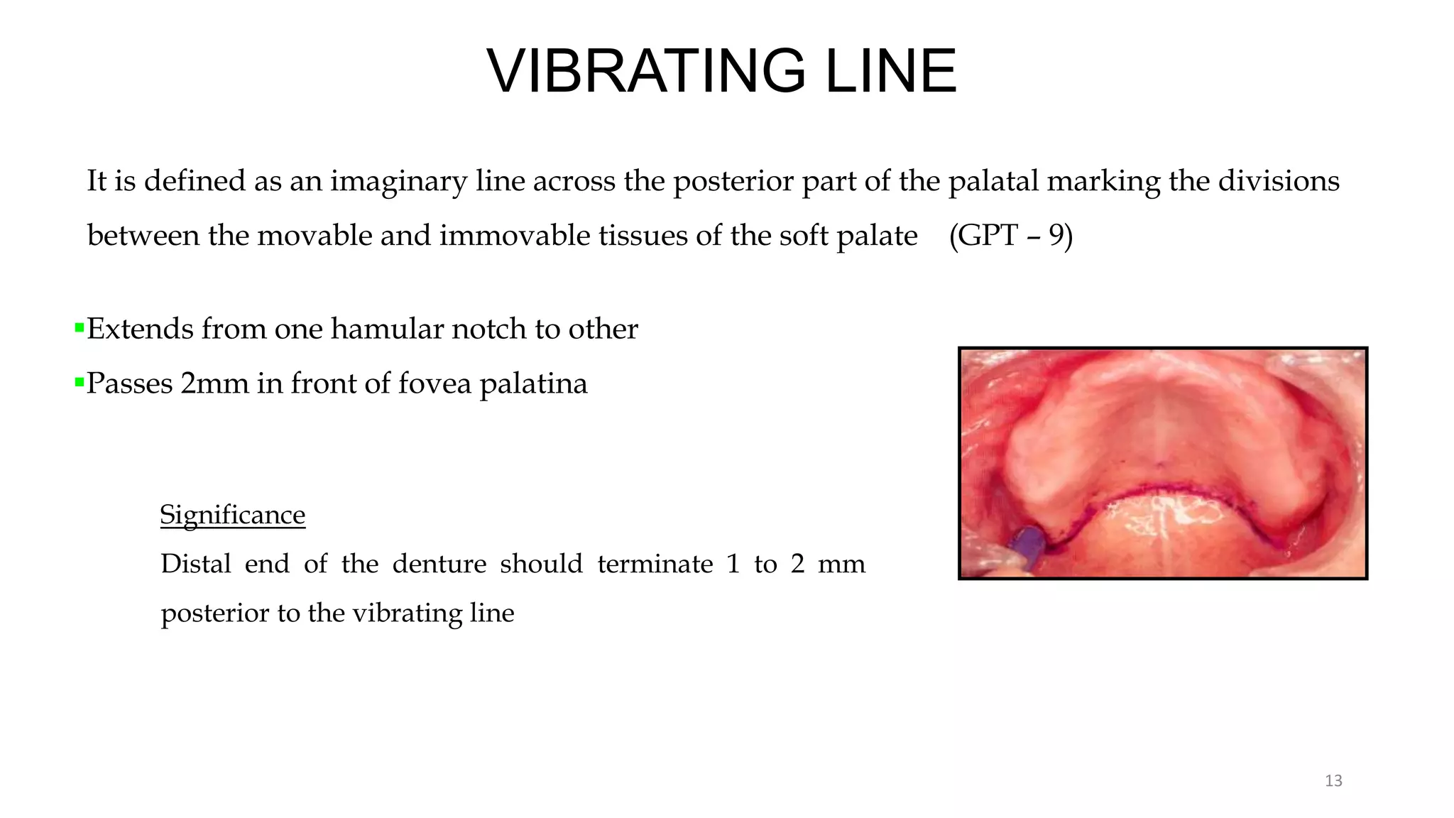 ANATOMICAL LANDMARKS AND PRIMARY IMPRESSION.pptx