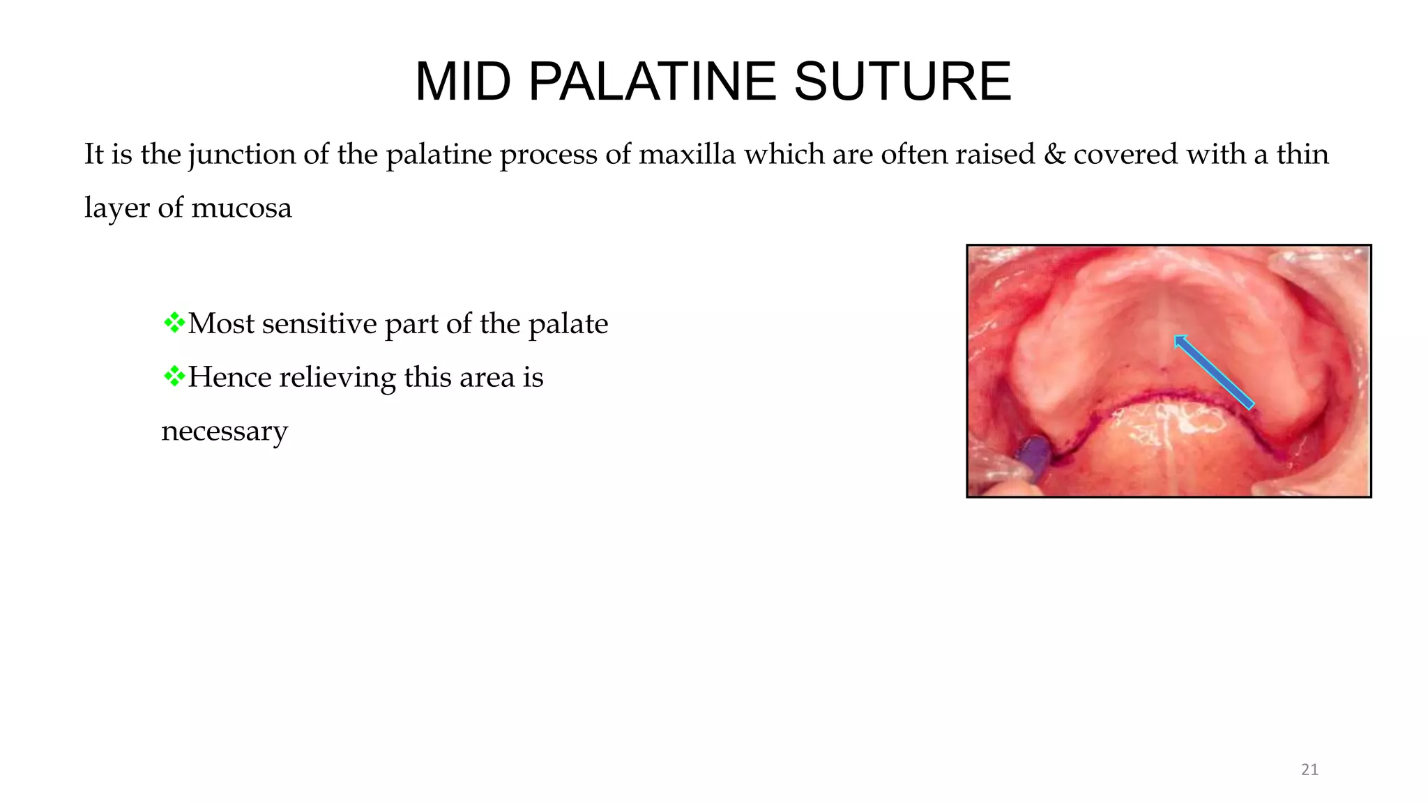 ANATOMICAL LANDMARKS AND PRIMARY IMPRESSION.pptx