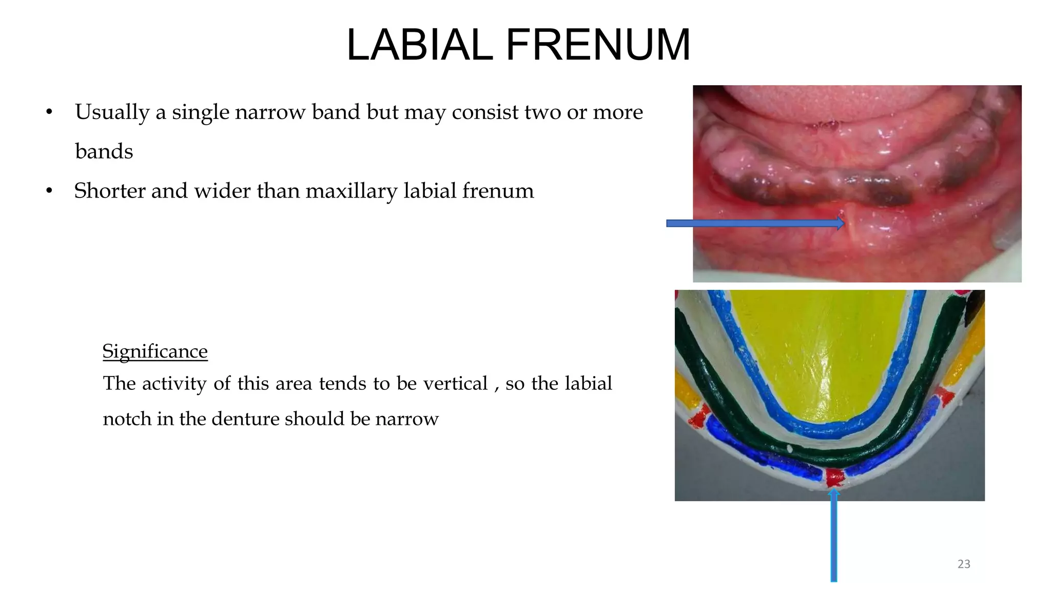 ANATOMICAL LANDMARKS AND PRIMARY IMPRESSION.pptx