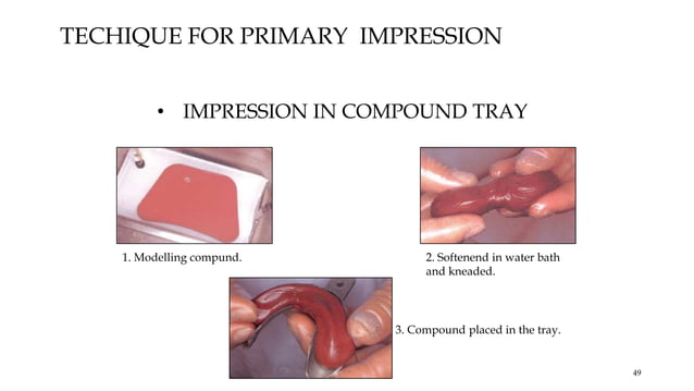 ANATOMICAL LANDMARKS AND PRIMARY IMPRESSION.pptx | Ear, Nose and Throat ...