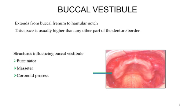 ANATOMICAL LANDMARKS AND PRIMARY IMPRESSION.pptx | Ear, Nose and Throat ...
