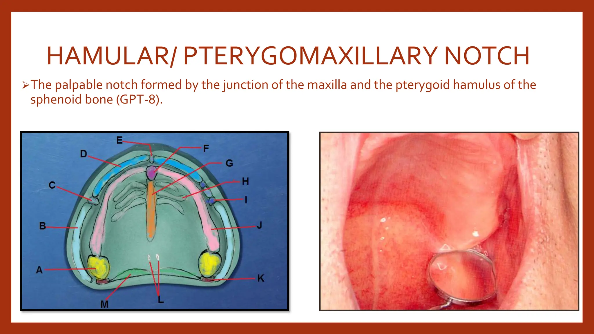 anatomical landmarks [Autosaved].pptx