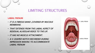 Anatomical landmarks in maxilla | PPTX | Ear, Nose and Throat ...