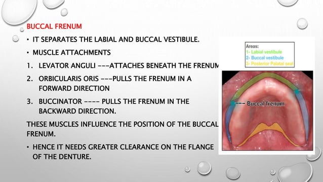 Anatomical landmarks in maxilla | PPT