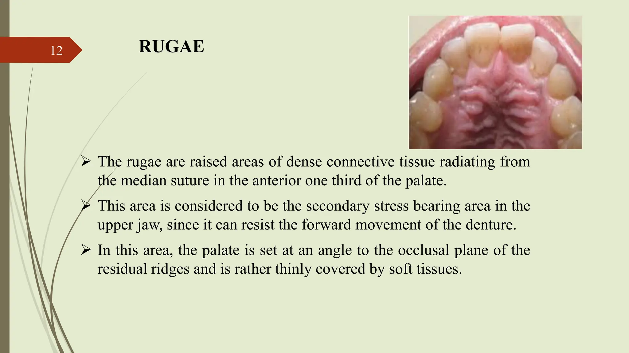 ANATOMICAL LANDMARKS IN MAXILLA and it's importance | PPTX