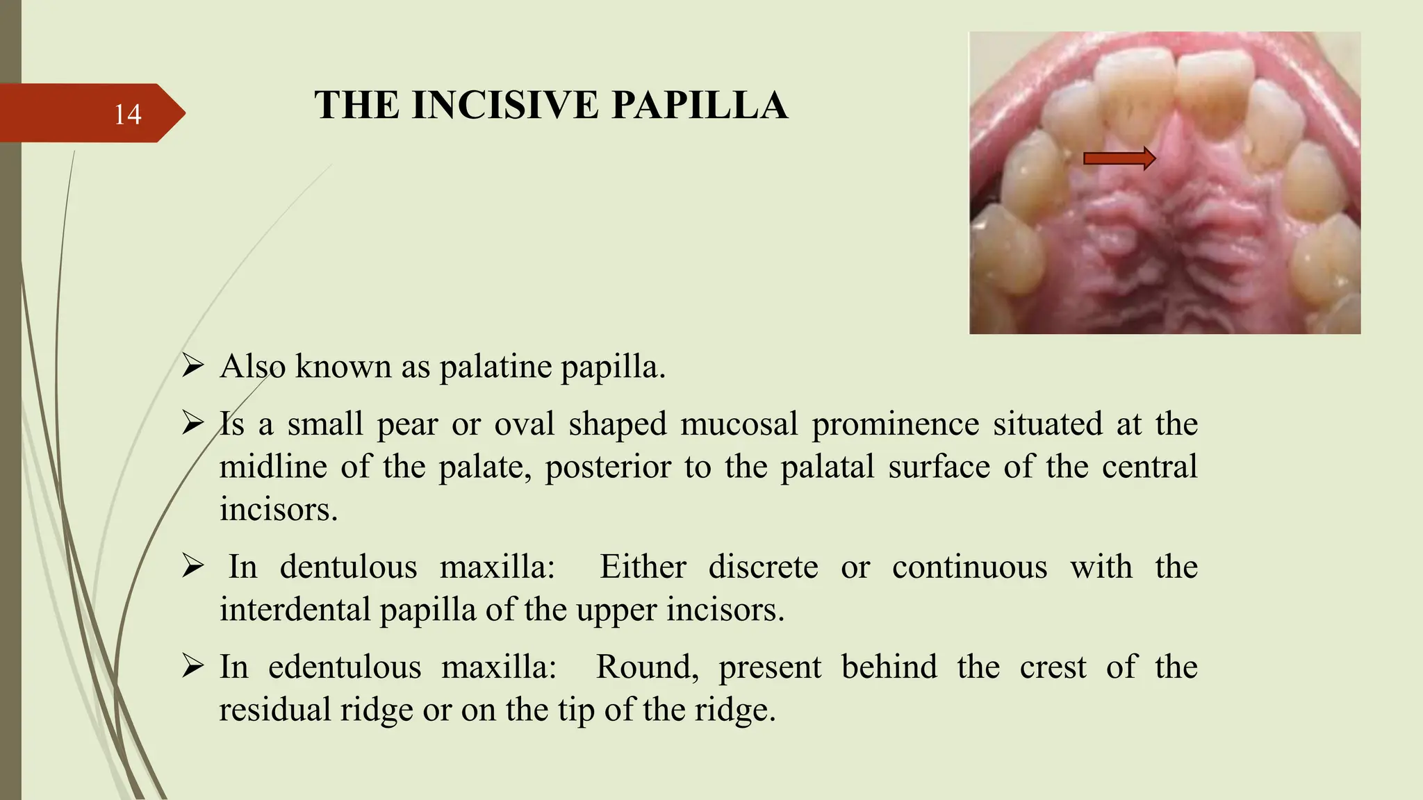 ANATOMICAL LANDMARKS IN MAXILLA and it's importance | PPTX