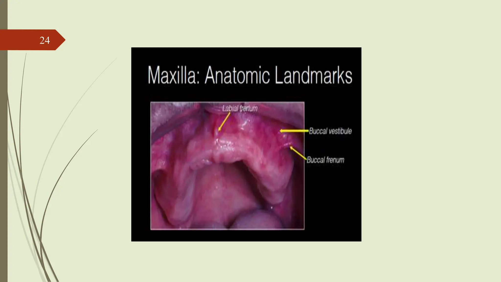 ANATOMICAL LANDMARKS IN MAXILLA and it's importance | PPTX