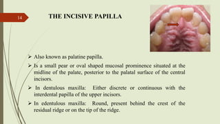 ANATOMICAL LANDMARKS IN MAXILLA and it's importance | PPTX