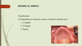 ANATOMICAL LANDMARKS IN MAXILLA and it's importance | PPTX