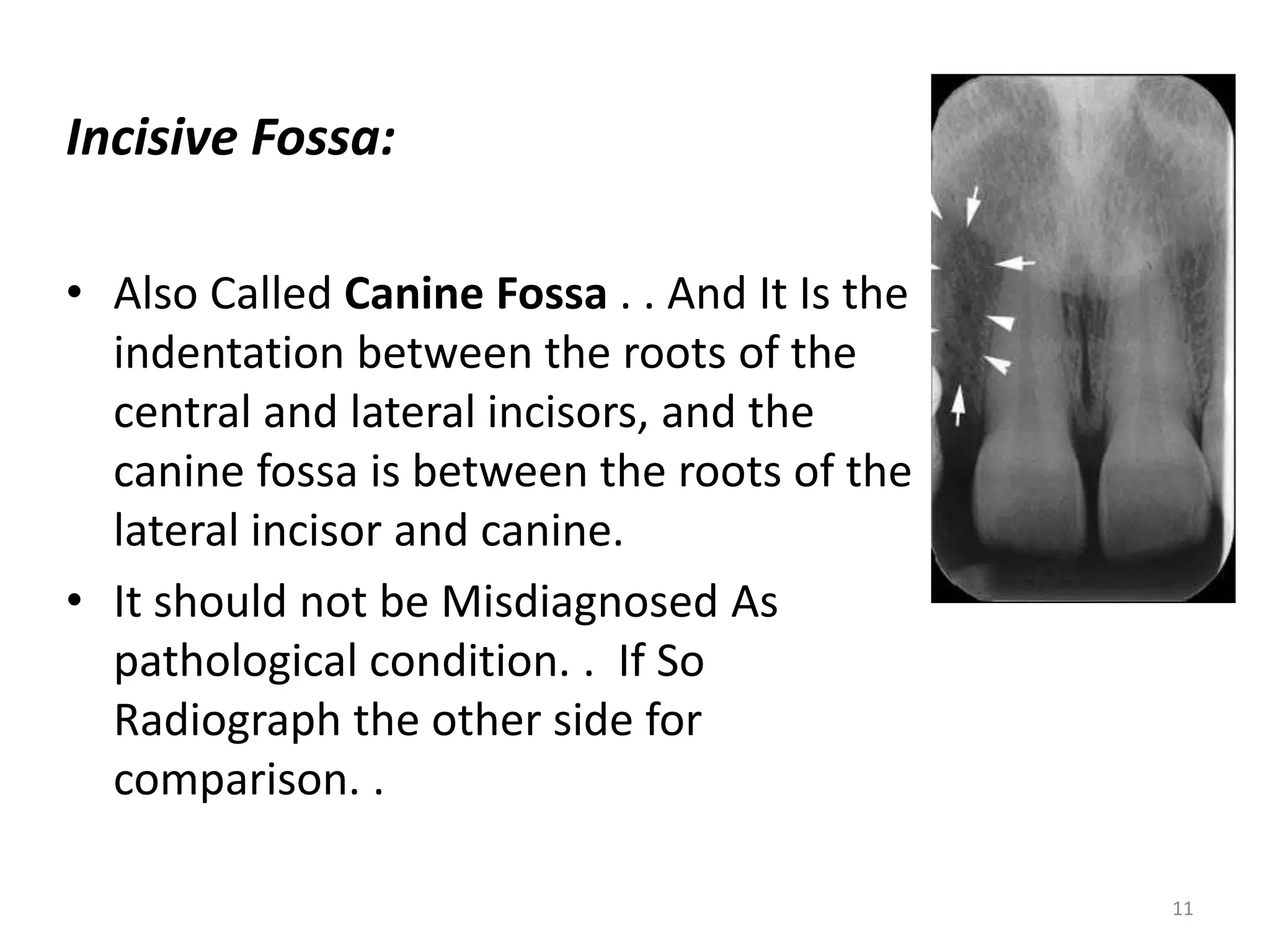 Anatomical landmarks in Periapical and Orthopantomogram X-ray | PPTX