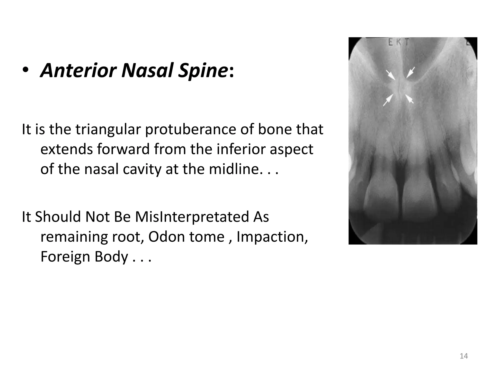 Anatomical landmarks in Periapical and Orthopantomogram X-ray | PPTX