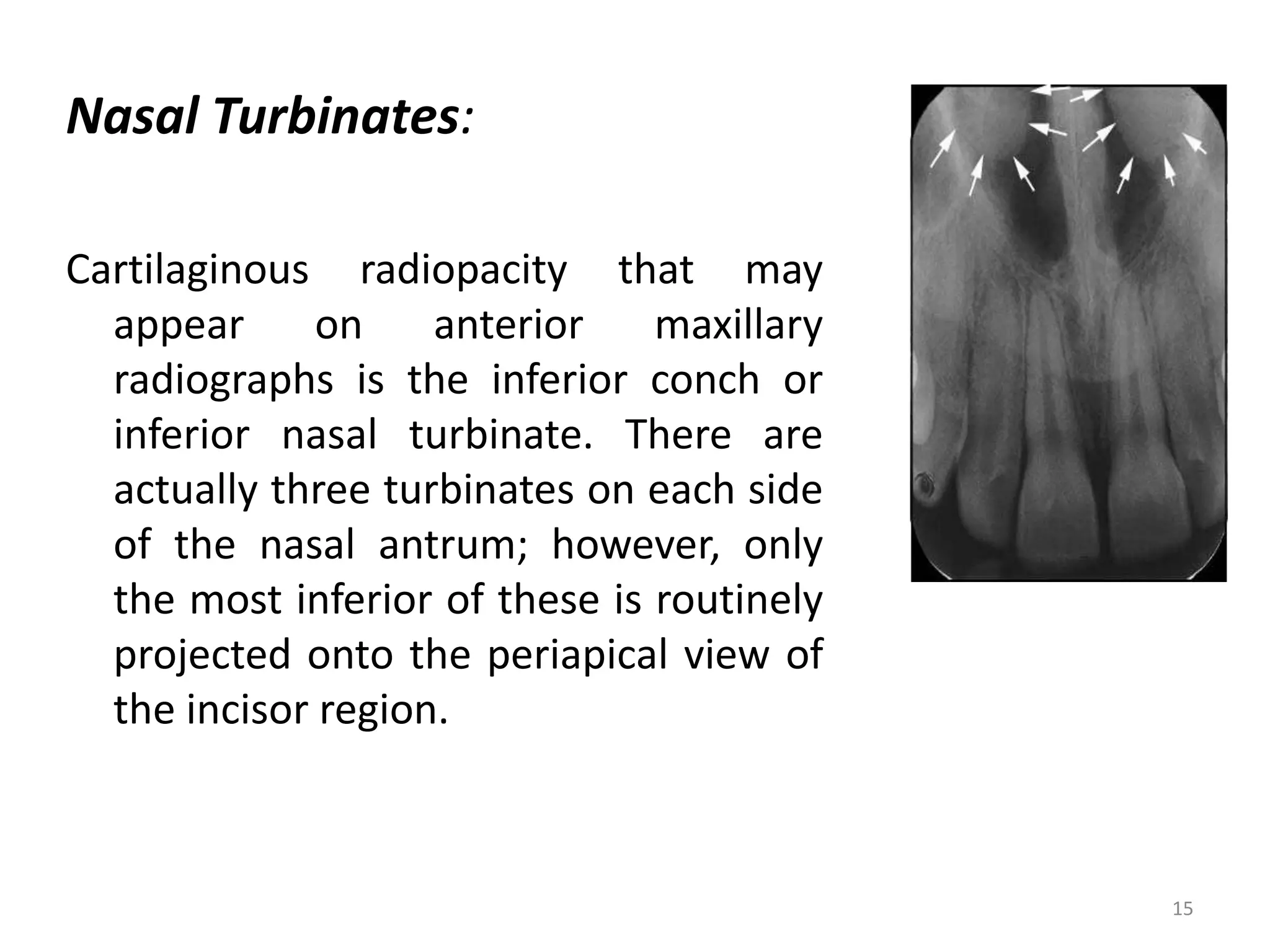 Anatomical landmarks in Periapical and Orthopantomogram X-ray | PPTX