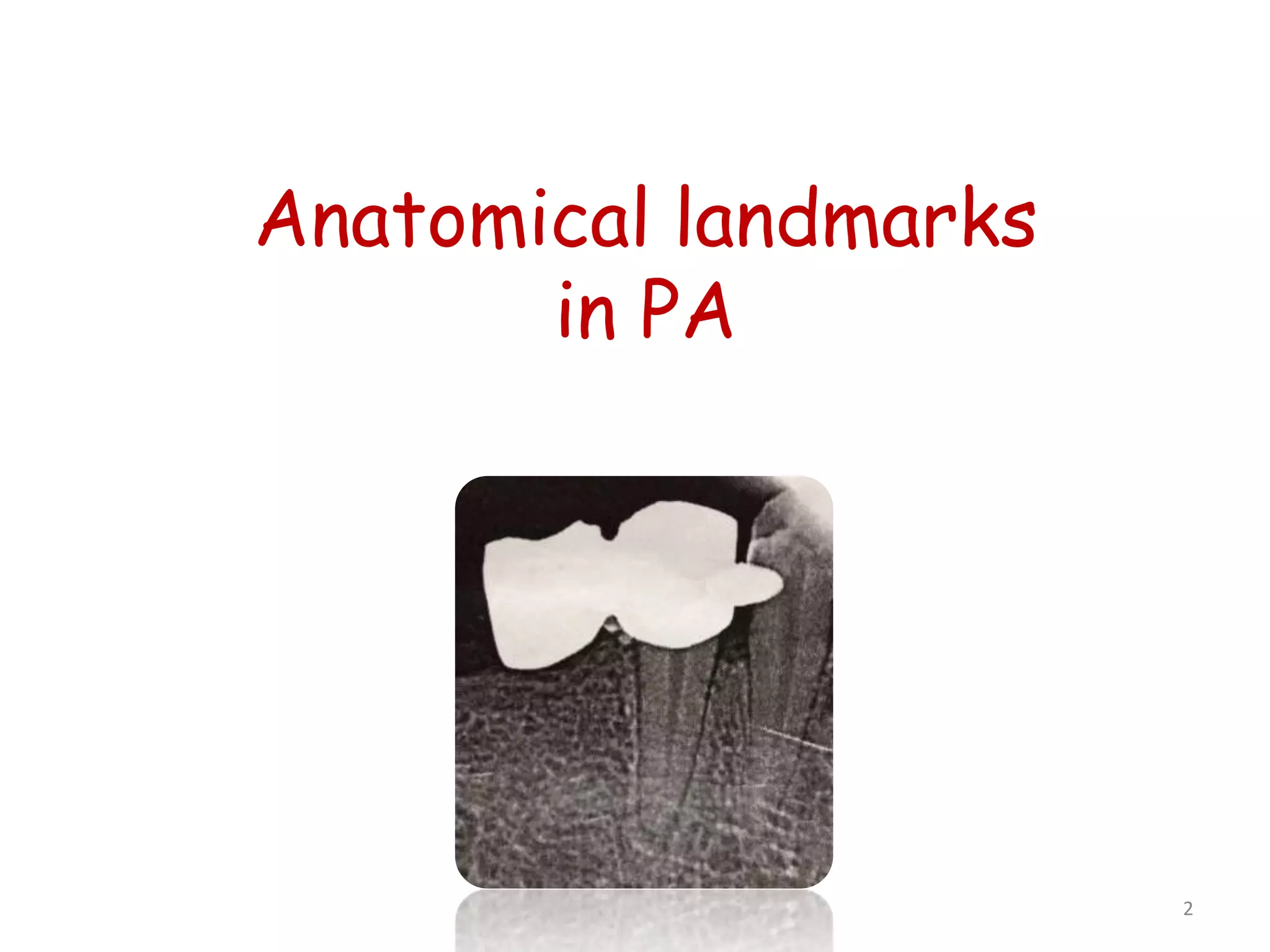 Anatomical landmarks in Periapical and Orthopantomogram X-ray | PPTX
