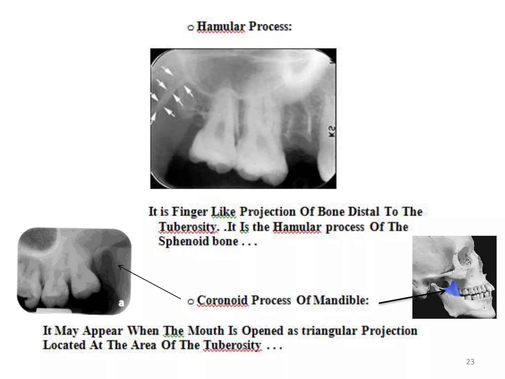 Anatomical landmarks in Periapical and Orthopantomogram X-ray | PPTX
