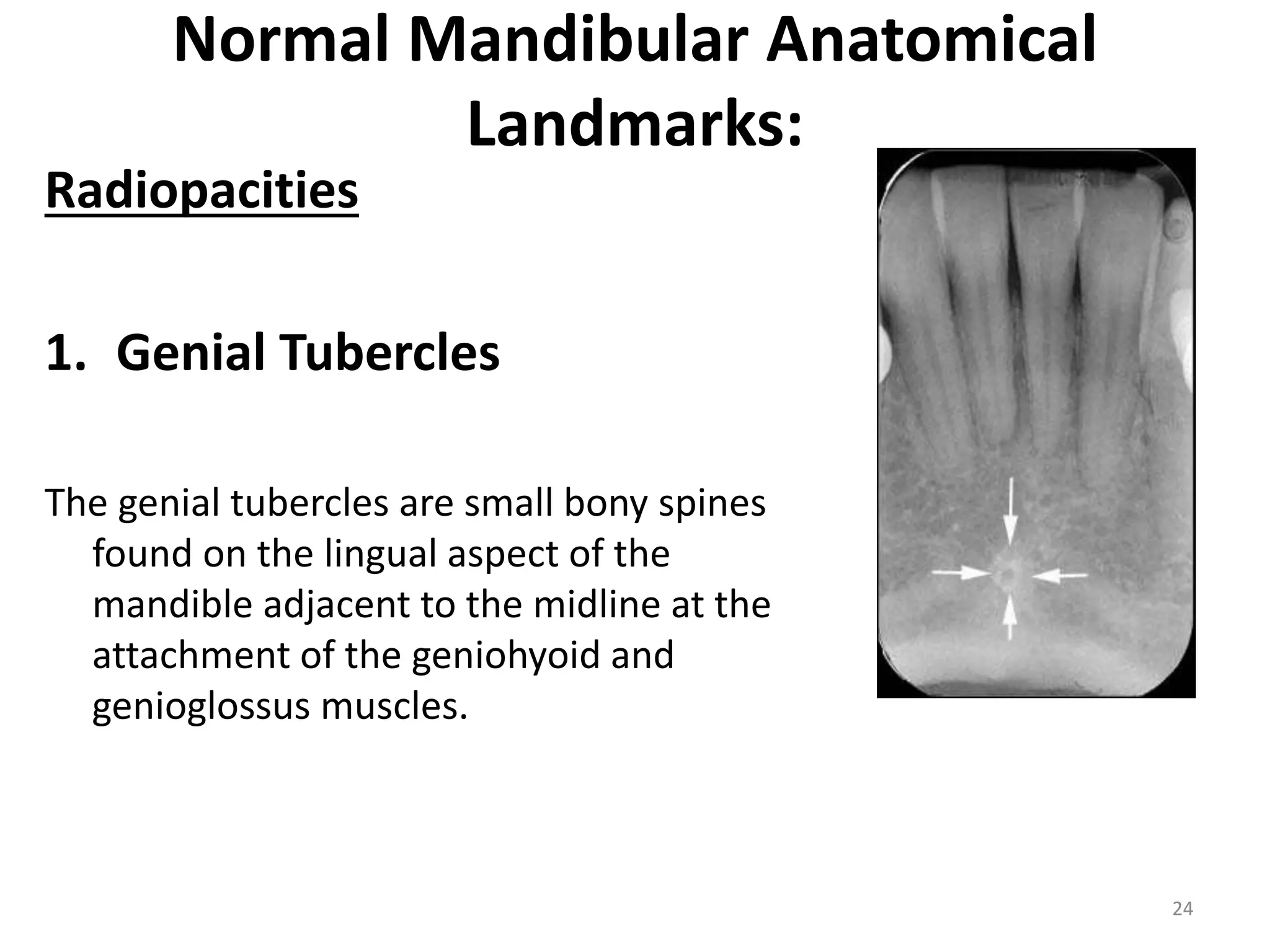 Anatomical landmarks in Periapical and Orthopantomogram X-ray | PPTX