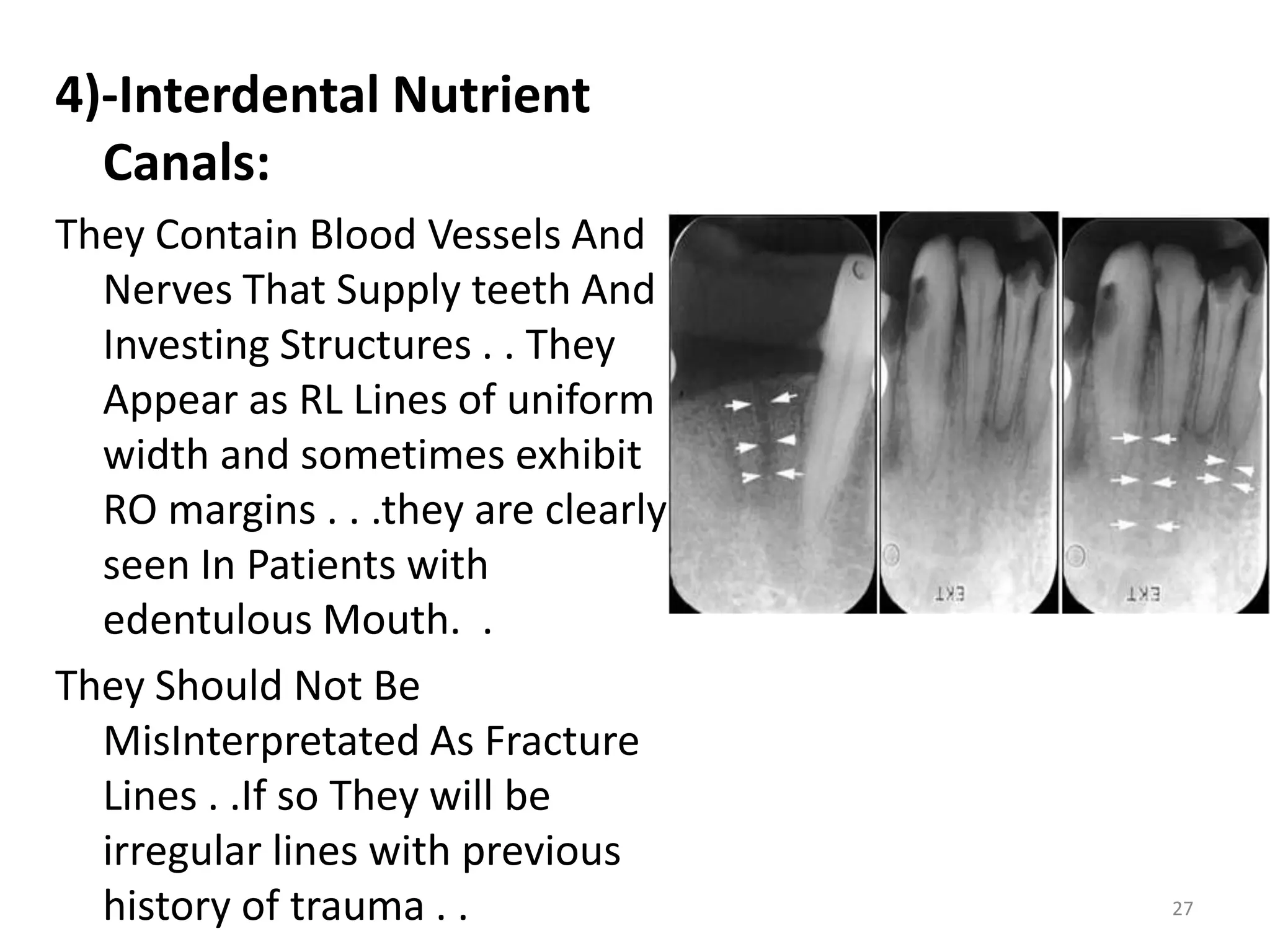 Anatomical landmarks in Periapical and Orthopantomogram X-ray | PPTX
