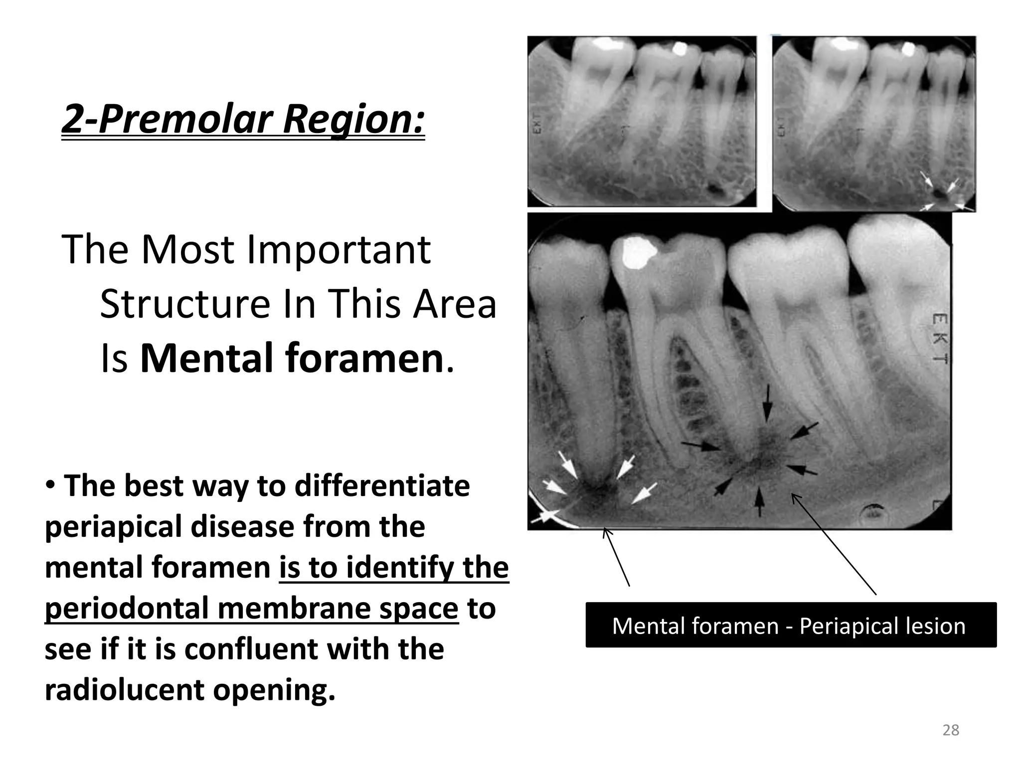 Anatomical landmarks in Periapical and Orthopantomogram X-ray | PPTX
