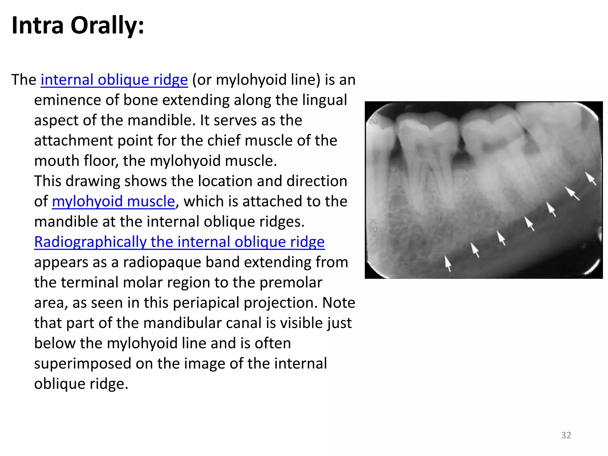 Anatomical landmarks in Periapical and Orthopantomogram X-ray | PPTX