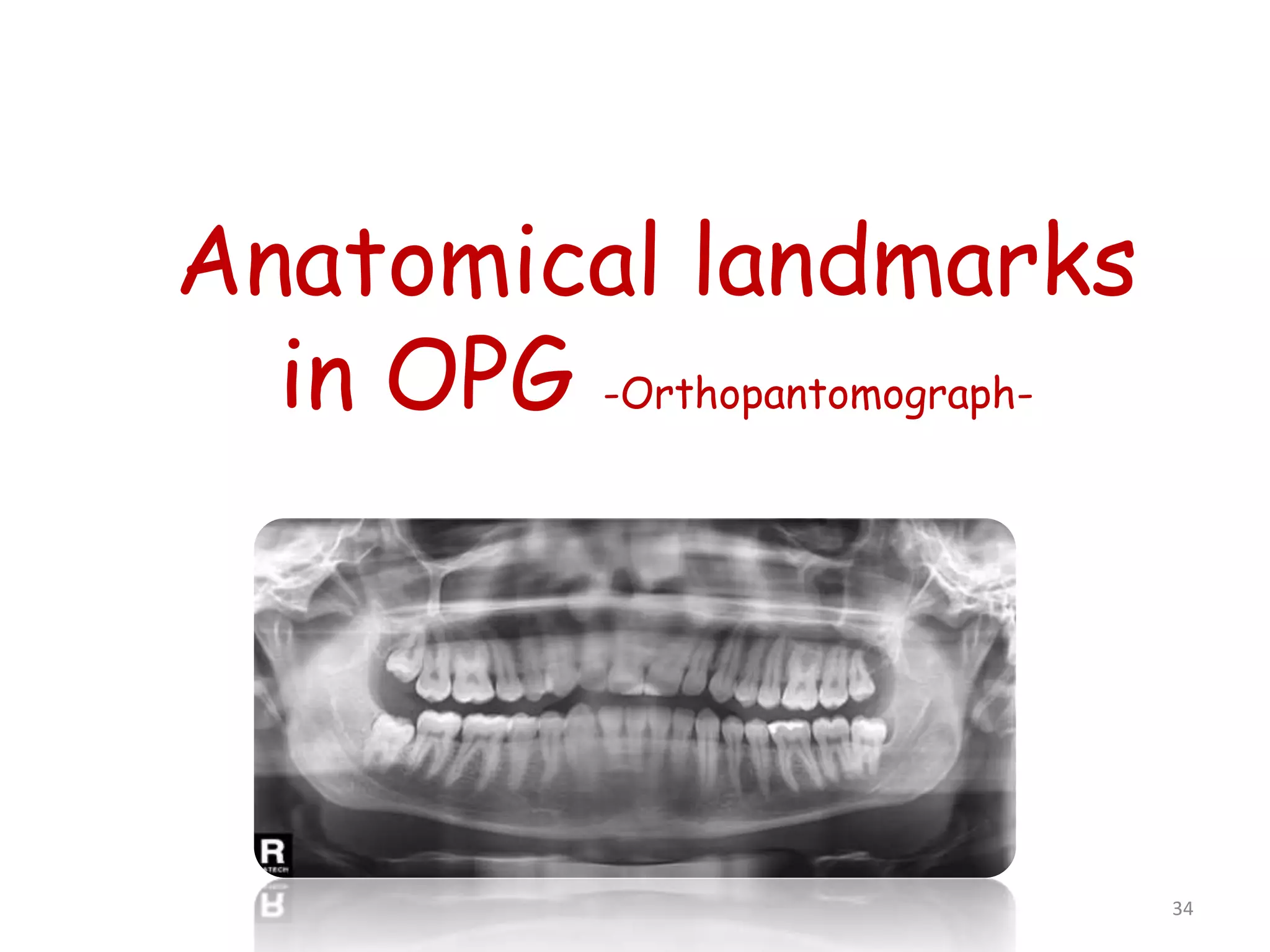Anatomical landmarks in Periapical and Orthopantomogram X-ray | PPTX