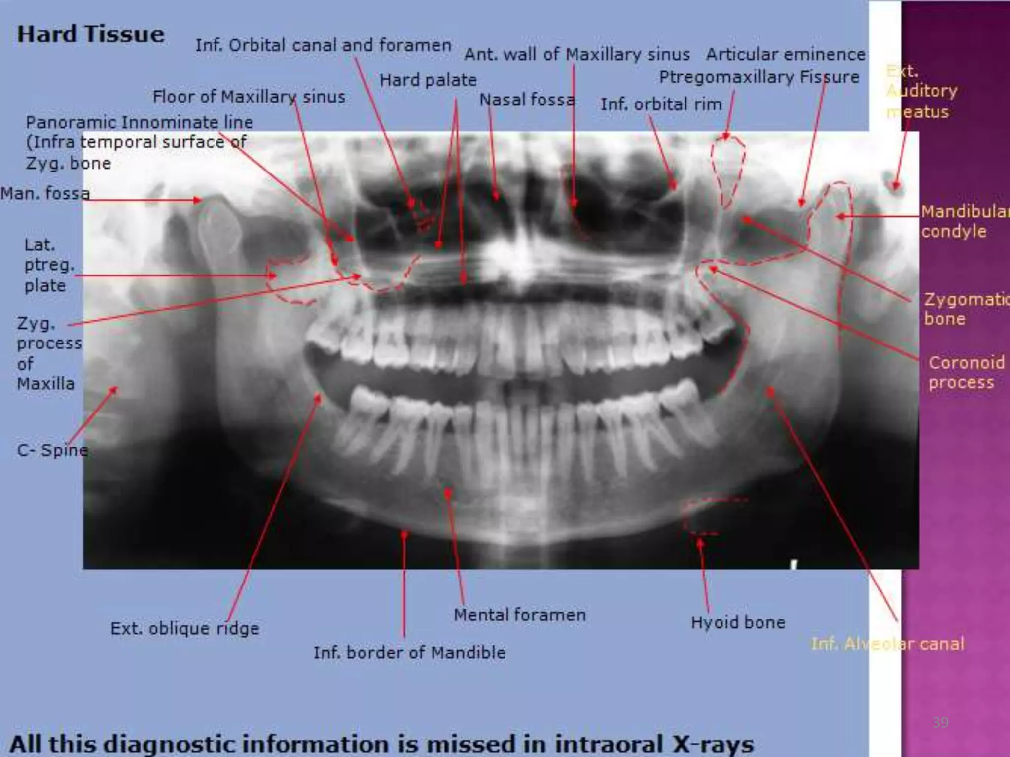 Anatomical landmarks in Periapical and Orthopantomogram X-ray | PPTX