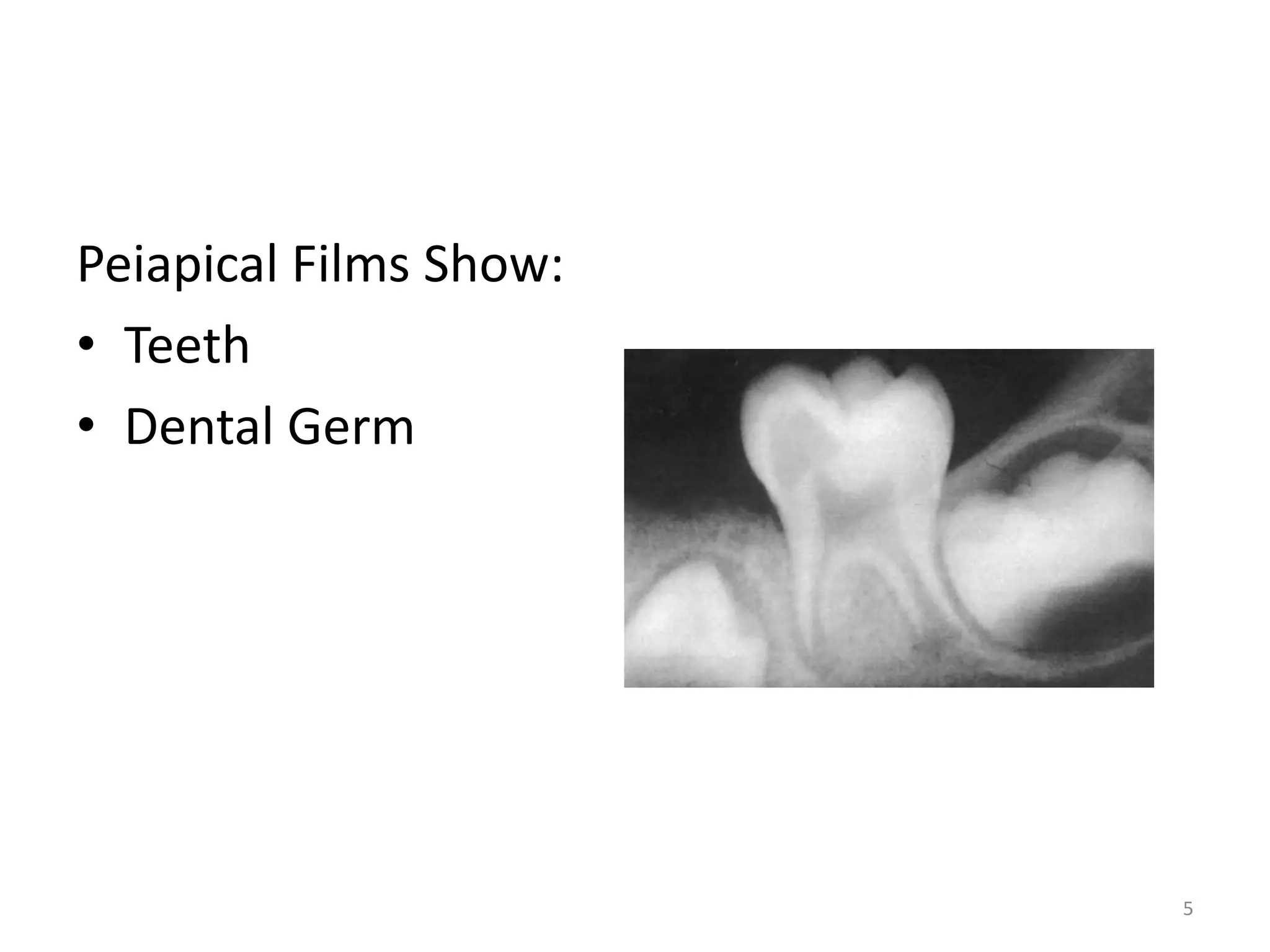 Anatomical landmarks in Periapical and Orthopantomogram X-ray | PPTX