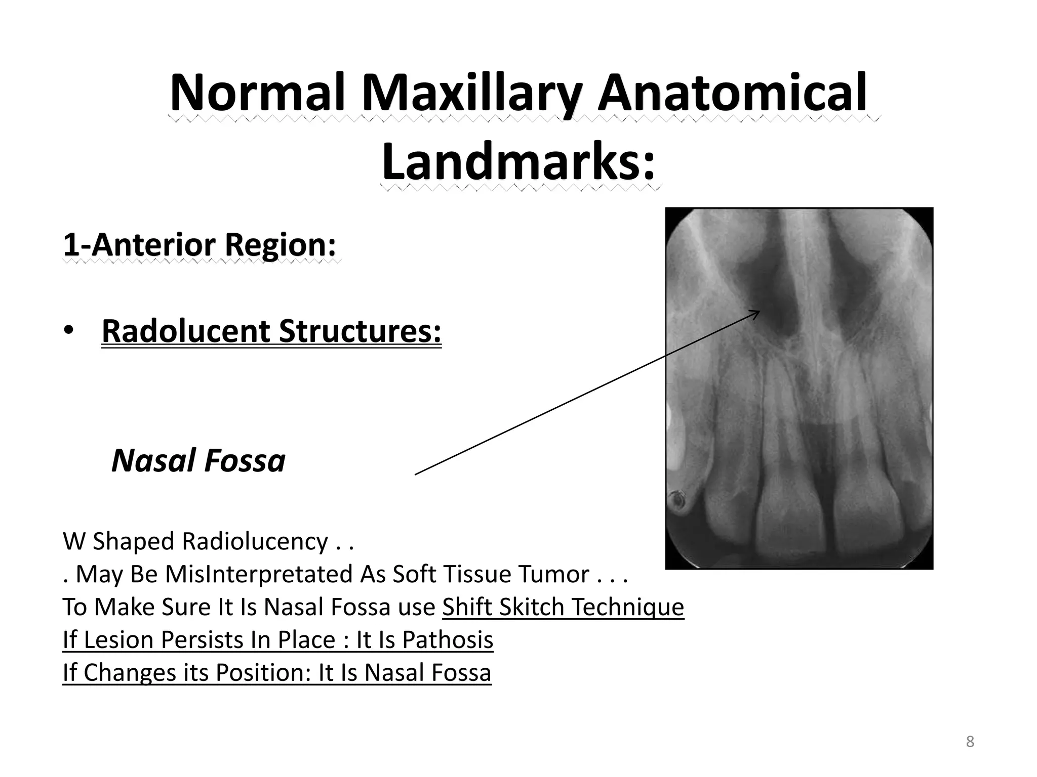 Anatomical landmarks in Periapical and Orthopantomogram X-ray | PPTX