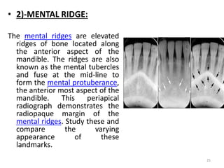 Genial Tubercles Xray