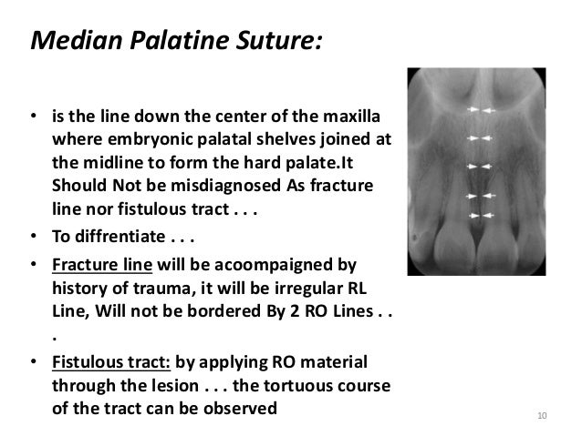 Anatomical landmarks in Periapical and Orthopantomogram X-ray