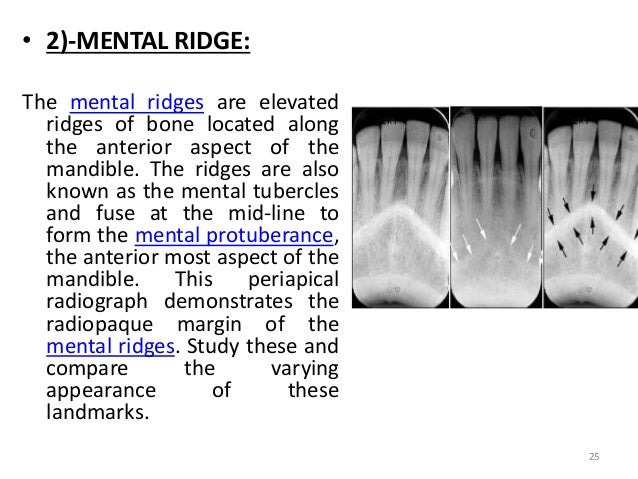 Anatomical landmarks in Periapical and Orthopantomogram X-ray