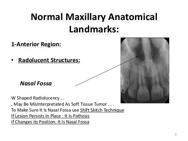 Anatomical landmarks in Periapical and Orthopantomogram X-ray